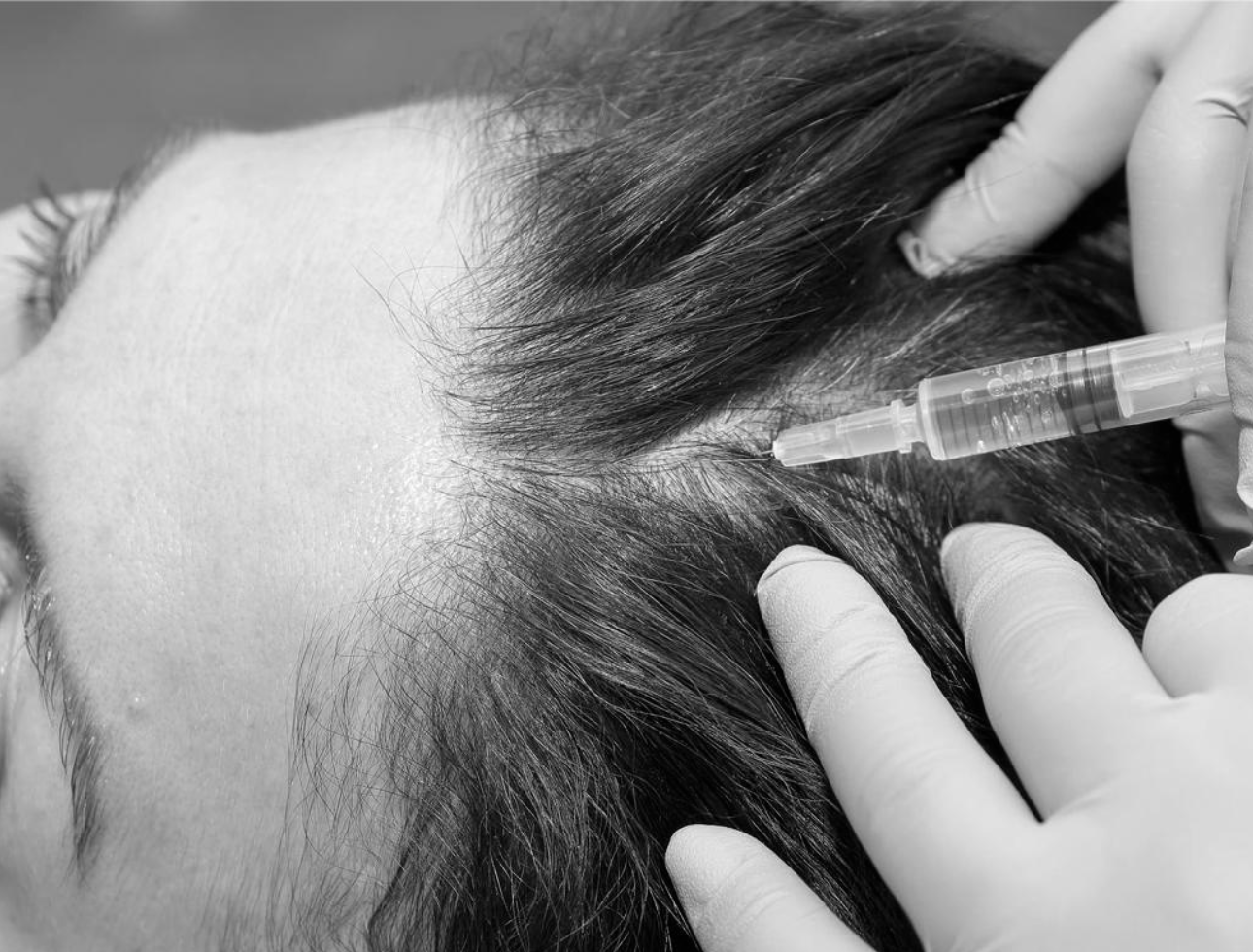 Biotin Injections – Letizia Rose Aesthetics